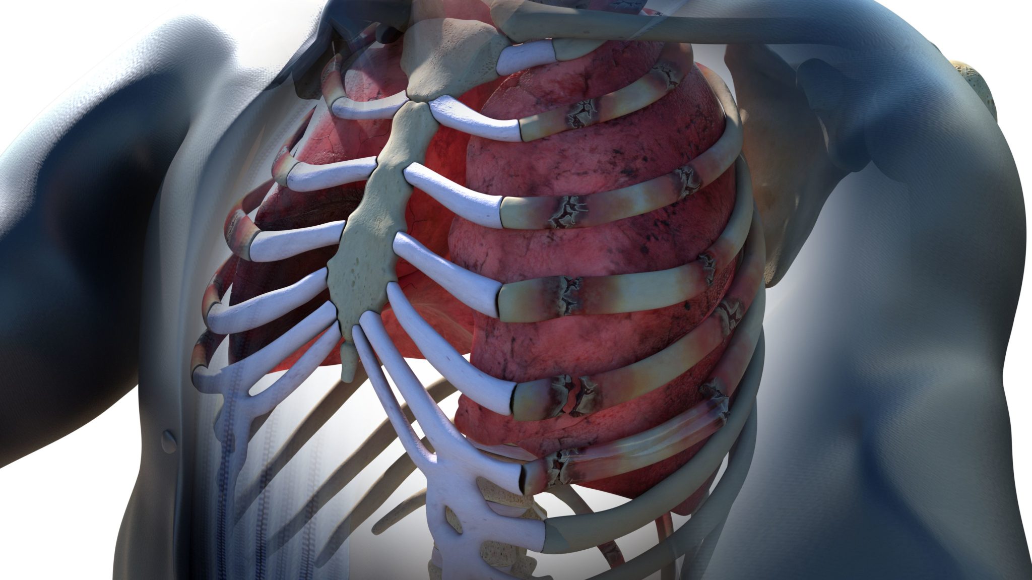 How to Win Your Case with Demonstrative Evidence