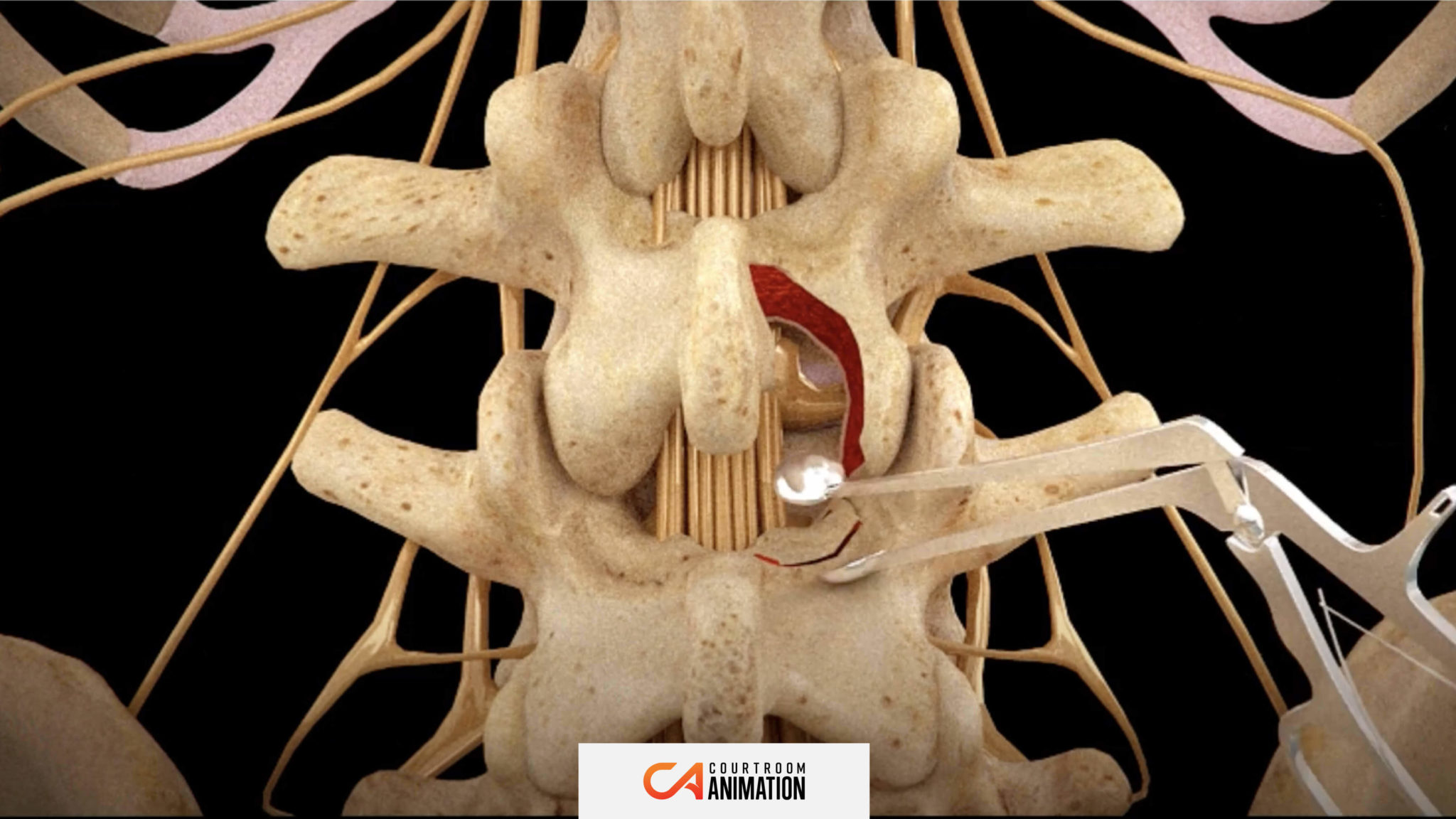 4 Things You Didn’t Know About Legal Medical Illustrations